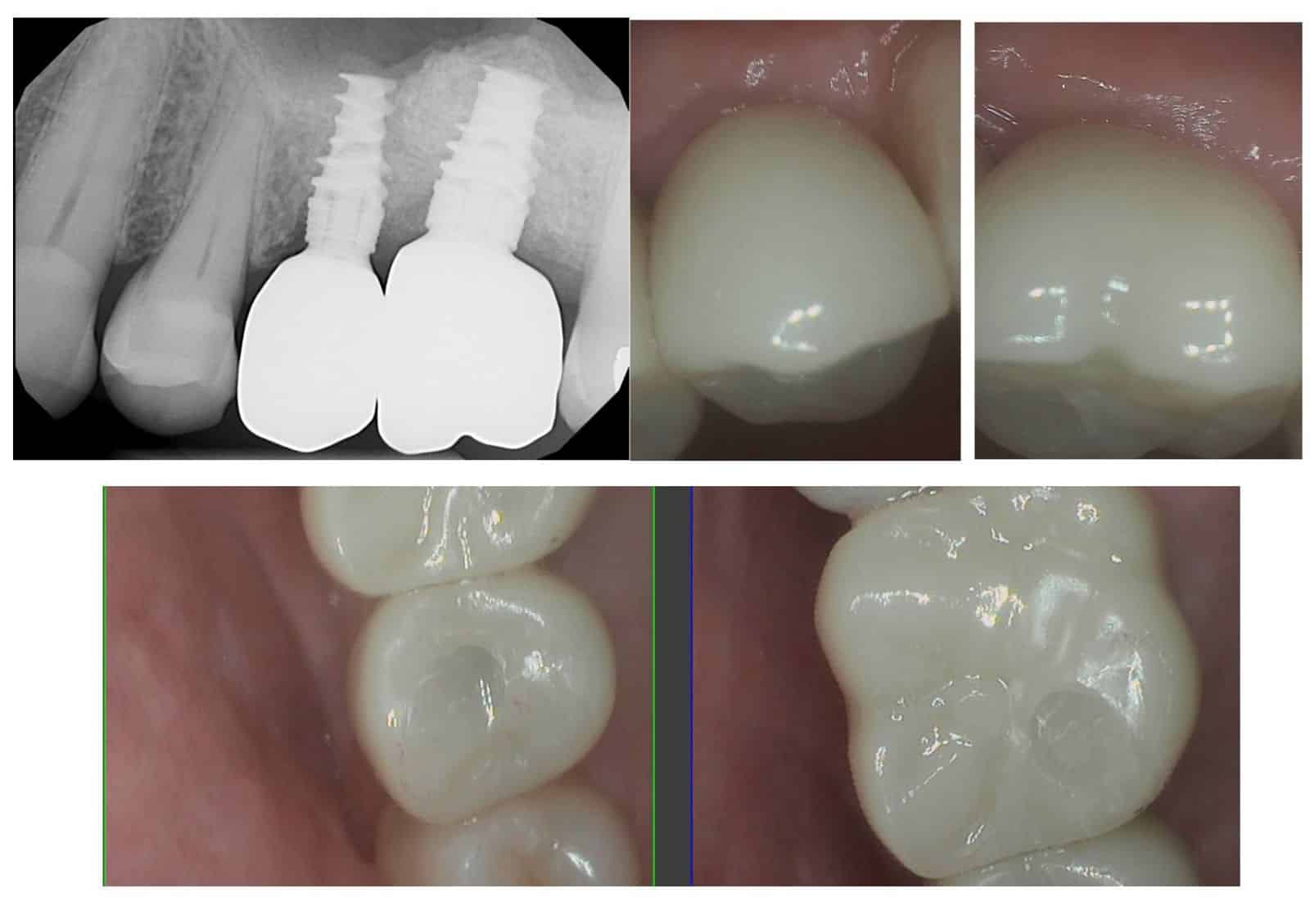 Smile Gallery | Schwenksville Dental Care